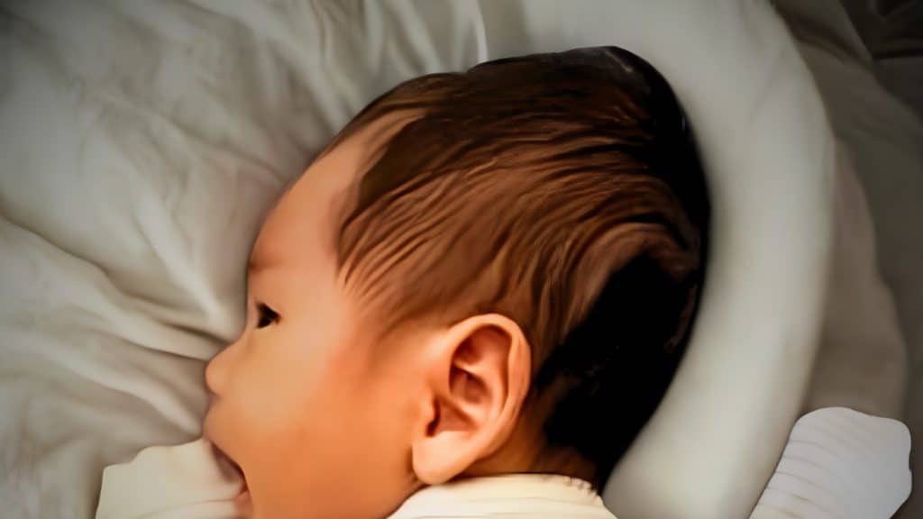 Don’t Panic: Understanding Your Baby’s Cone-Shaped Head - Mothers Always Right