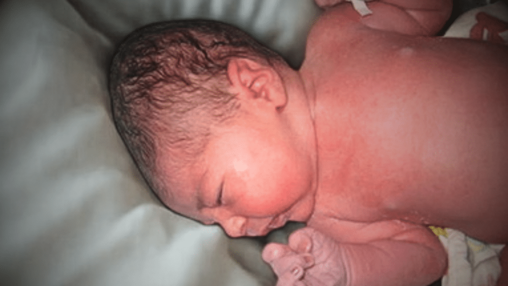 Don’t Panic: Understanding Your Baby’s Cone-Shaped Head - Mothers ...
