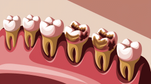 Is Milk Rotting Your Teeth? Here's the Truth! - Mothers Always Right
